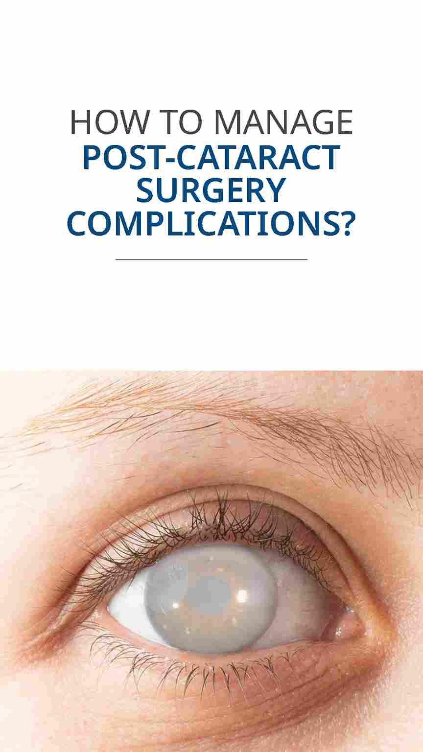 Cataract Surgery And Your Vision Cataract Surgery And Your Vision